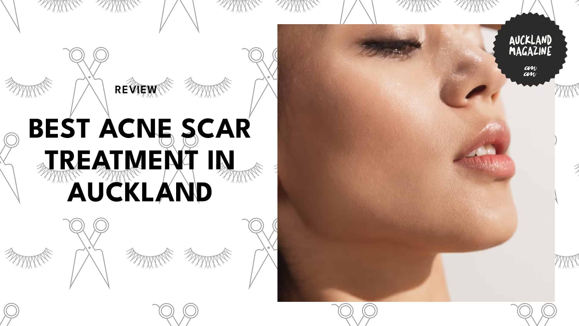 5 Best Acne Scar Treatments in Auckland [2026 ]